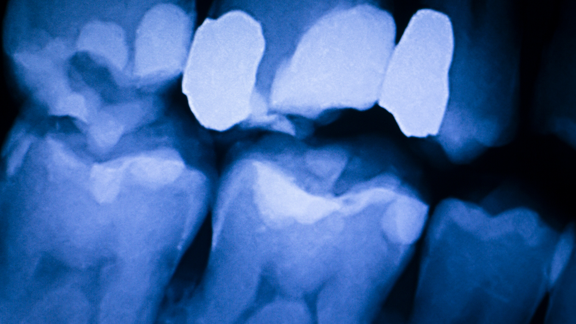 The Art of Chewing: Unlock The Benefits of Functional Nutrition